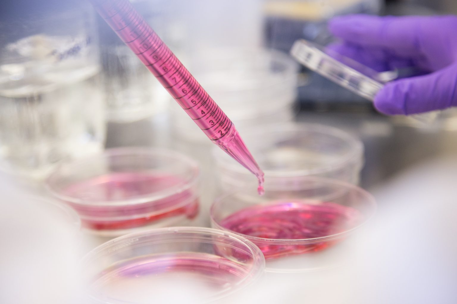 A-Z of genetic and rare conditions - Genetic Alliance