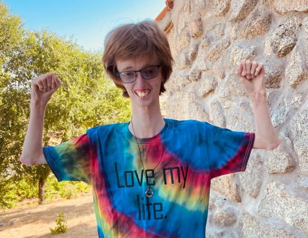 A-Z of genetic and rare conditions - Genetic Alliance